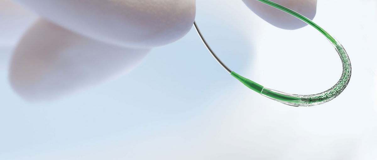 Un asunto del corazón